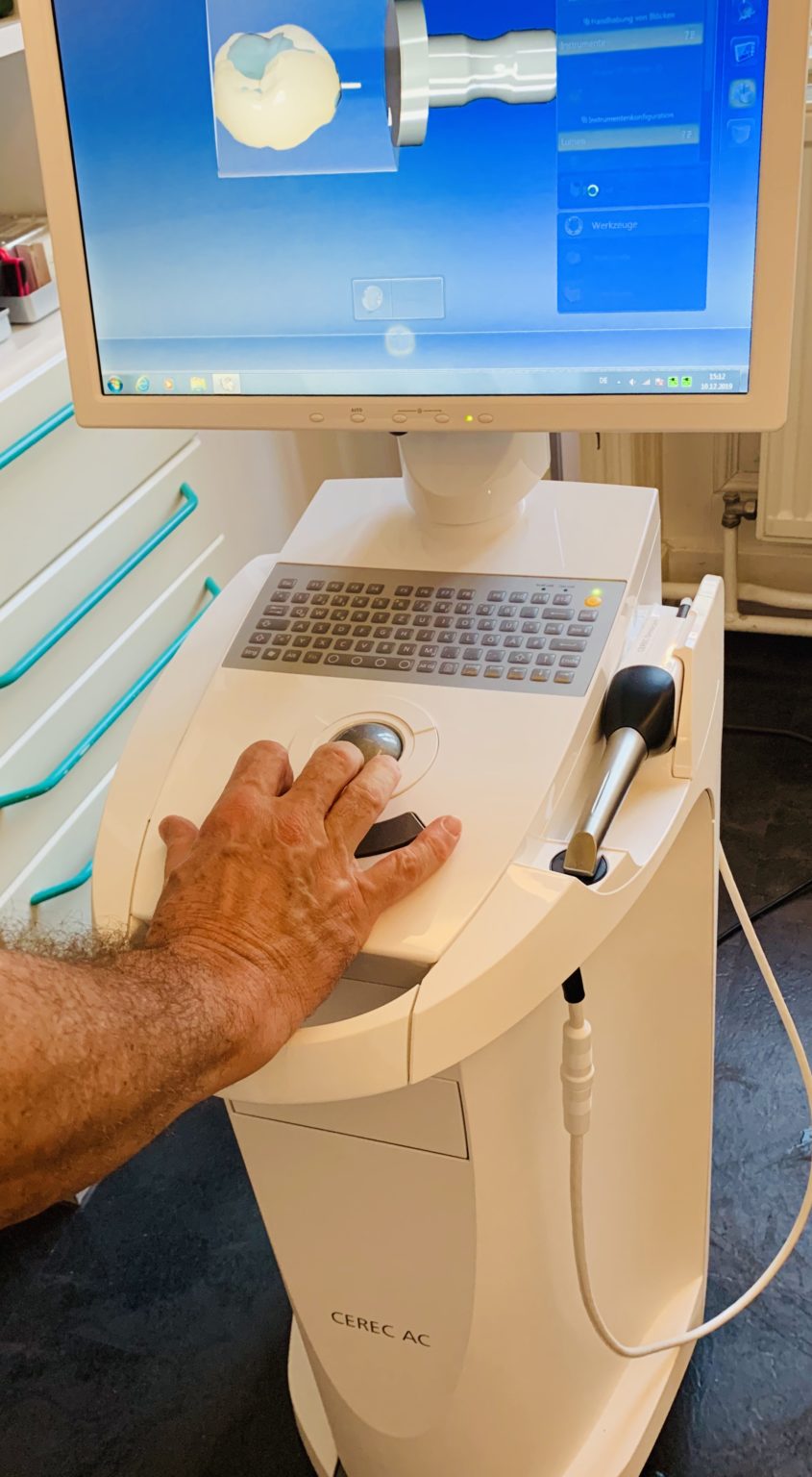 Cerec Krone - Zahnarzt Wien | Dr. Piehslinger Zahnärzte Oper - Karlsplatz