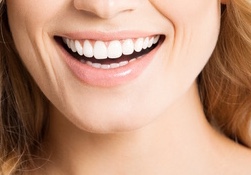 Zahnarzt-Wien Dr. Piehslinger Vollkeramik-Zahnkronen